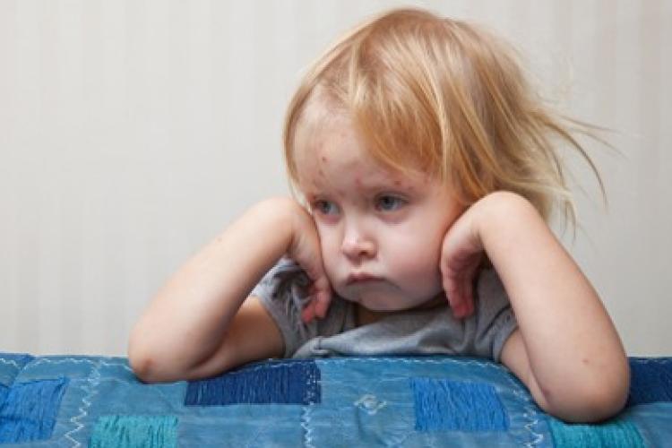 Masern: Besonders für Kleinkinder Risiko tödlicher Spätfolgen - urbia.de